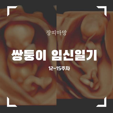 [쌍둥이 임신일기 12~15주차] 일산차병원 1차 기형아검사 입체초음파 임산부 감기 네이버 블로그