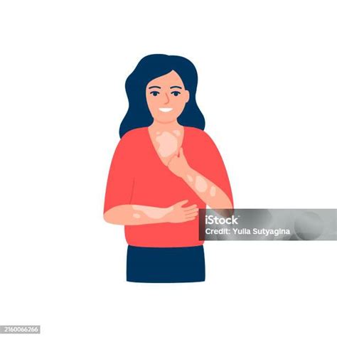 행복 한 젊은 여자의 피부에 백반증 부위 색소 침착이 다른 색상의 몸체 자기 사랑과 자기 관리 자가면역질환 벡터 개성 개념에 대한 스톡 벡터 아트 및 기타 이미지 Istock