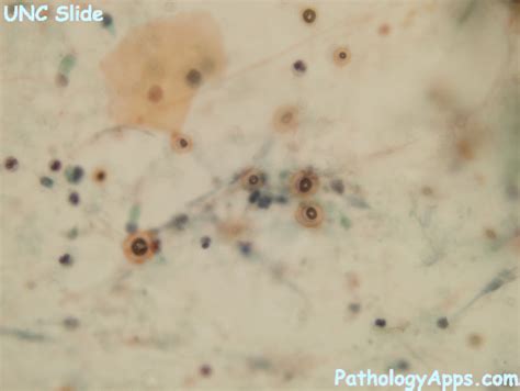 Expand All Collapse All