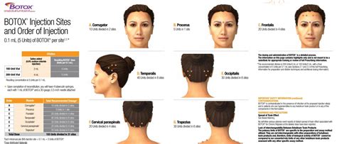 Botox Injection Sites For Migraine Treatment Are All Doctors Doing