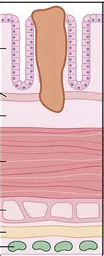 Stages Of CRC Flashcards Quizlet