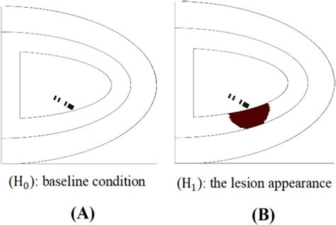Models Used In Distinguishability Test Z Score Calculation The Case