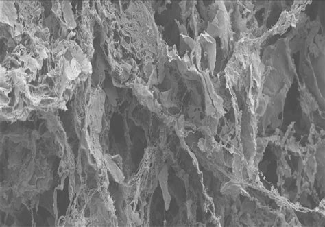 How To Analyze Sem Image Using Imagej Fiji Researchgate