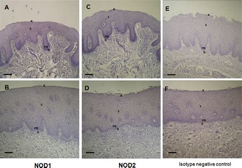 Immnohistochemical Analysis Of Nucleotide Binding Oligomerization