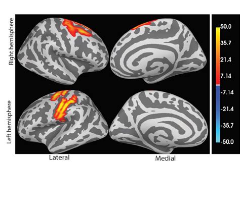 Bi Directional Plots Showing Significant Clusters Of The Contrast Download Scientific Diagram