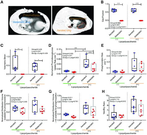 Regional Lung Function At H Of One Lung Atelectasis And Systemic Download Scientific Diagram