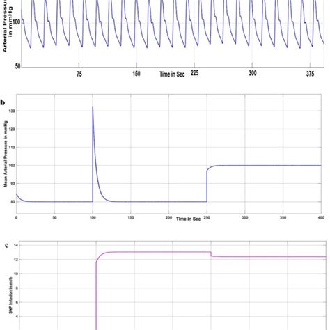 Cascade Control Outcome For Sensitive Patient A Bp B Mean Arterial Download Scientific