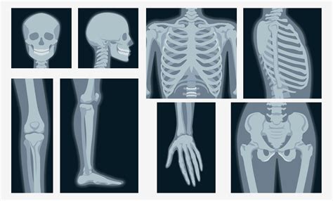 Different X Rays Shot Of Human Body Part Set 1233807 Vector Art At Vecteezy