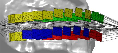 Figure 9 From Camera Clustering For Multi Resolution 3 D Surface