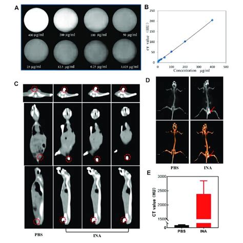 A B Ct Images And The Corresponding Plot Of The Ct Value Hu Of Download Scientific