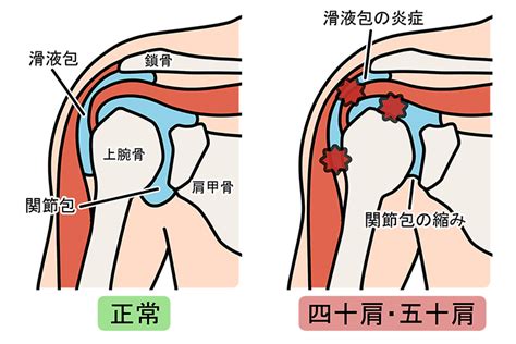 肩｜須藤整形外科クリニック｜神奈川県大和市 高座渋谷の整形外科