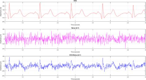 ecg waveform a noise signal of strength k and the ecg signal with