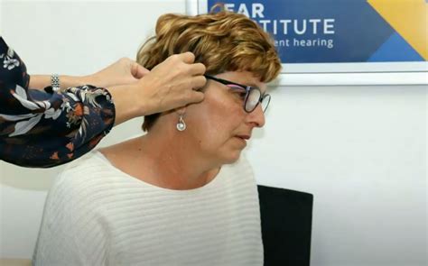 Kate Calitz Cochlear Implant Activation Dr Gerrie Moolman