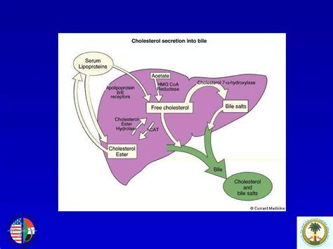 Biliary Pancreatitis Ppt