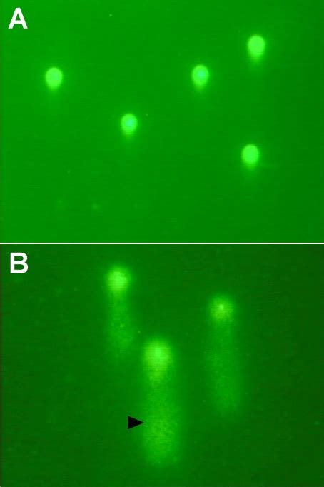 photographs of cells analyzed by comet assay analysis a photograph a