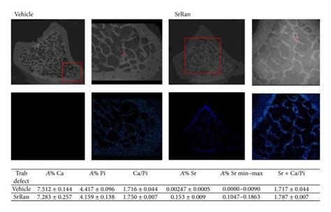 X Ray Spectroscopy Of Proximal Tibia Cross Section Of Two Download Scientific Diagram