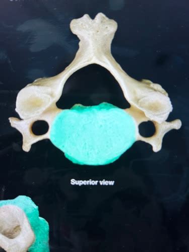 Cervicle Vertebra Flashcards Quizlet Cervicle Vertebra Flashcards Quizlet