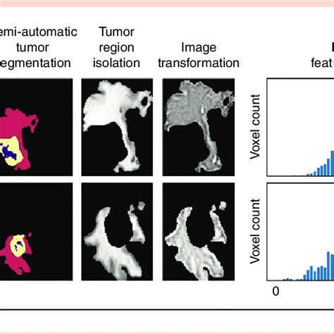 Diagram Of Radiomic Feature Extraction From Mri Feature Extraction Download Scientific Diagram