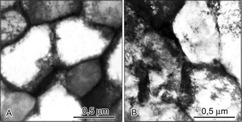 Microstructure Of Austenite In Initial State A And After Repeated γ Download Scientific