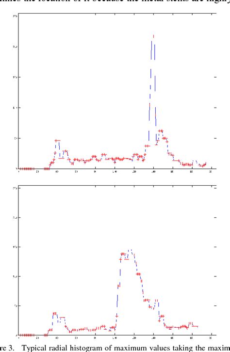 Figure 1 From Stent Strut Detection In Intravascular Optical Coherence Tomography Semantic Scholar