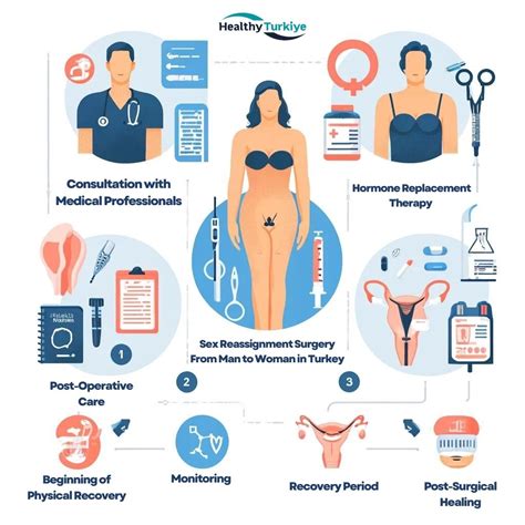 Intercourse Procedure Women