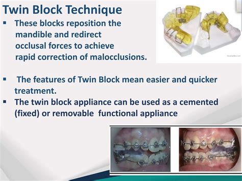 Twin Block Appliance In Orthodontics Pptx