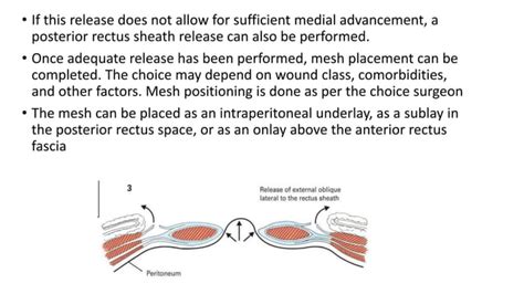 Component Sepration Techniquespptx