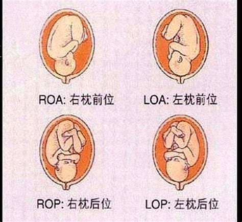 lsa胎位图示意图 千图网