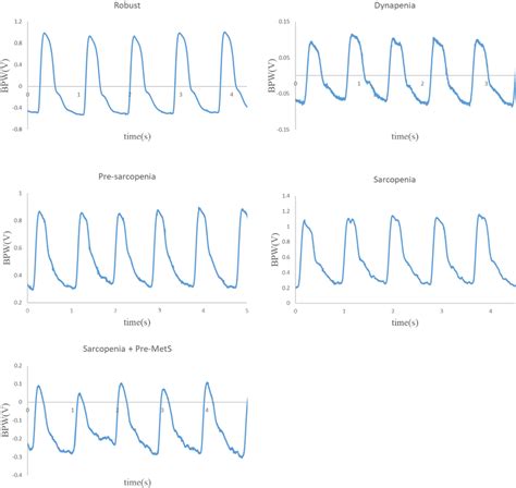 Typical Bpw Waveforms Measured In Arbitrary Units Download