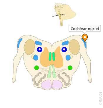 Cochlear Nuclei E Anatomy Imaios
