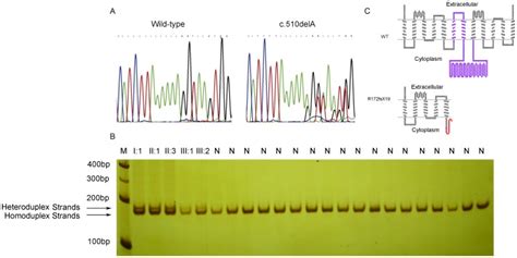 A Sequencing Chromatogram Showing The Heterozygous C 510dela Mutation