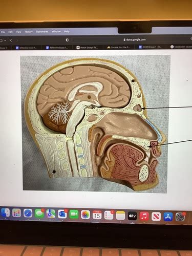 A P Lab Exam Flashcards Quizlet