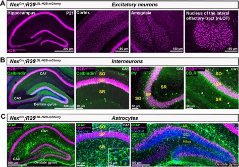 Pyramidal Neurons Hippocampus