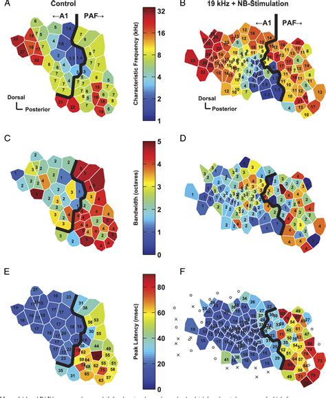 Figure 1 From Plasticity In The Rat Posterior Auditory Field Following Nucleus Basalis