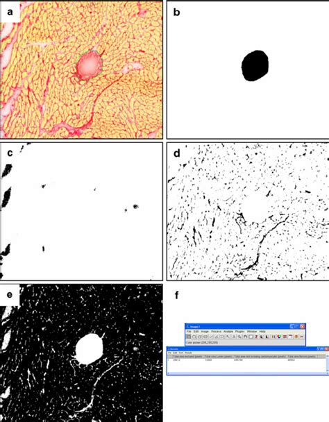 This Figure Shows The Different Steps Of The Imagej Macro In