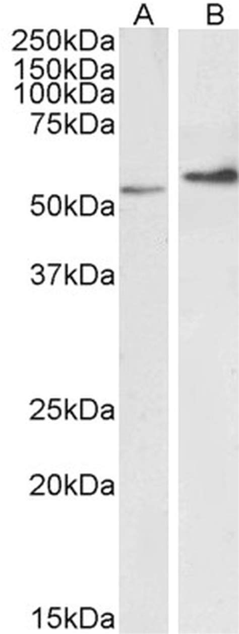 Vimentin Polyclonal Antibody Pa5 142829