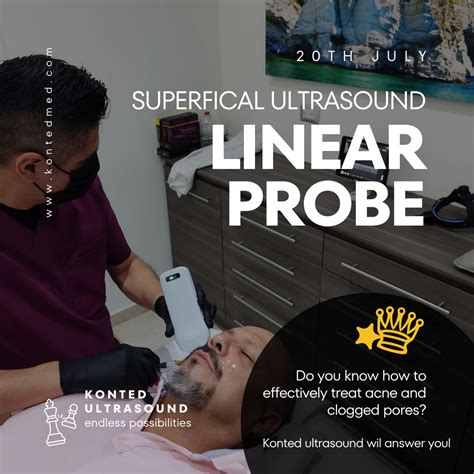 Linear Vs Convex Ultrasound Probe Beijing Konted Medical Technology Co Ltd