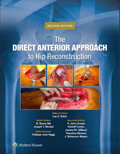 The Direct Anterior Approach To Hip Reconstruction
