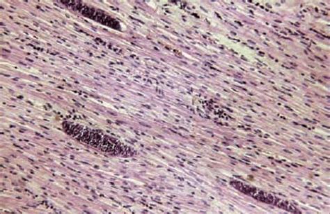 Sarcocystis Spp In Cows Bovis Vetlexicon