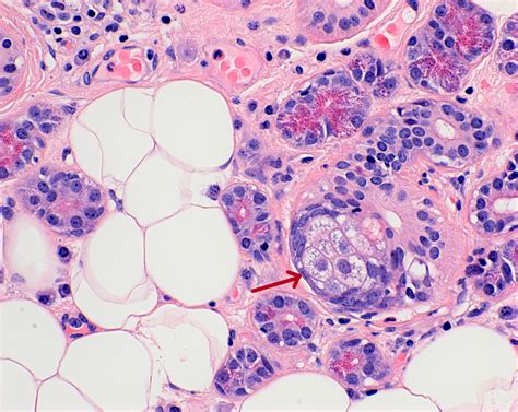 Parotid Gland Histology Adipose Tissue Loose Connective Tissue