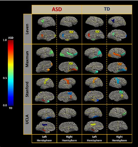 figure 1 from understanding autism using machine learning a structural
