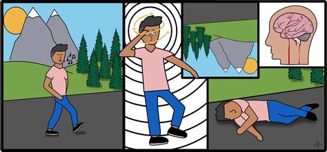 Turning The World Upside Down Reversal Of Vision Metamorphopsia In A