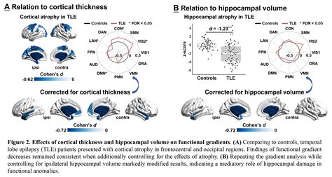 Atypical Functional Connectome Hierarchy In Temporal Lobe Epilepsy