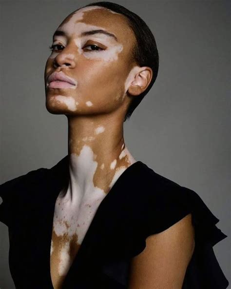 Pin On Common Skin Disorders And Diseases