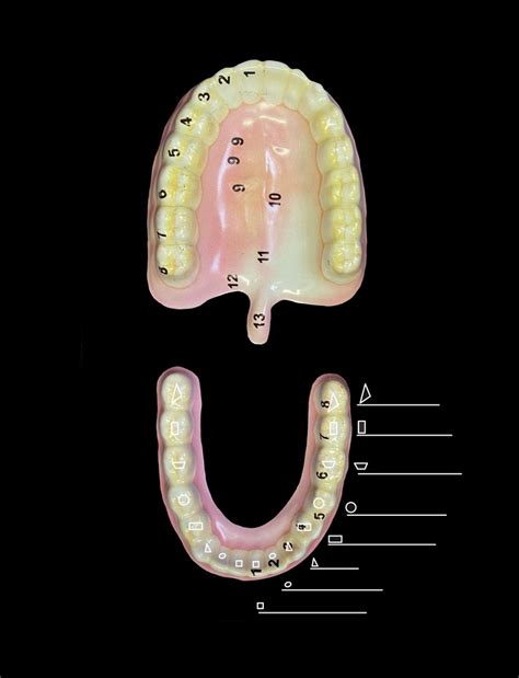 Week Teeth Model Diagram Quizlet