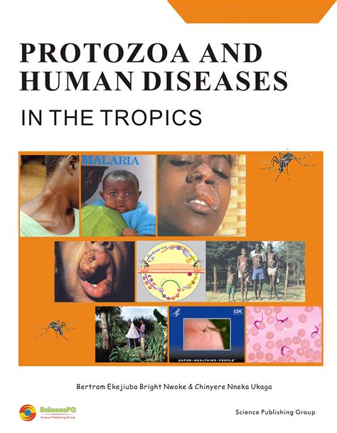 What Disease Is Caused By Protozoa Pregnant Health Tips