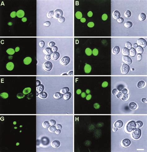 Localization Of Five Tpx Gfp Fusion Proteins In Yeast Cell Cells Were
