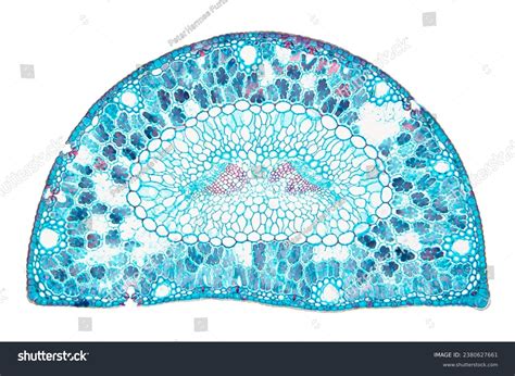 Cross Section Of A Leaf Microscope Cranberry Leaf Cross Section Under