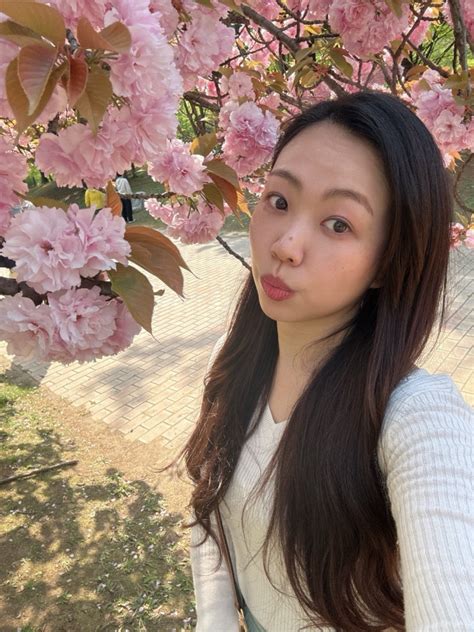 압구정성형외과 인라인쌍꺼풀 매몰쌍수 · 눈밑지방재배치 9개월 차 후기 전후 비교 네이버 블로그