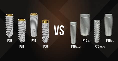 Conical Internal Connection Vs Internal Hex Which Is Better